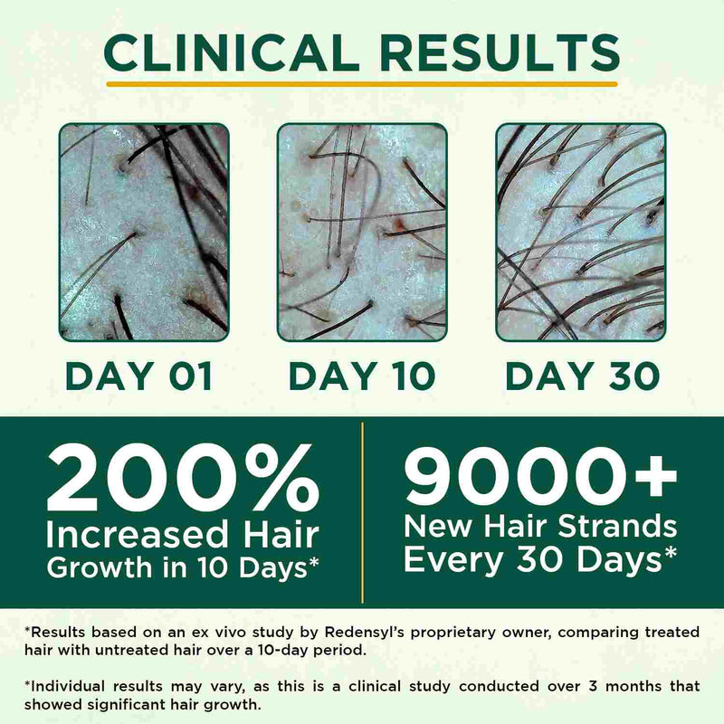 Buy Hair Growth Serum | 3% Redensyl Hair Growth Serum – Orgatre